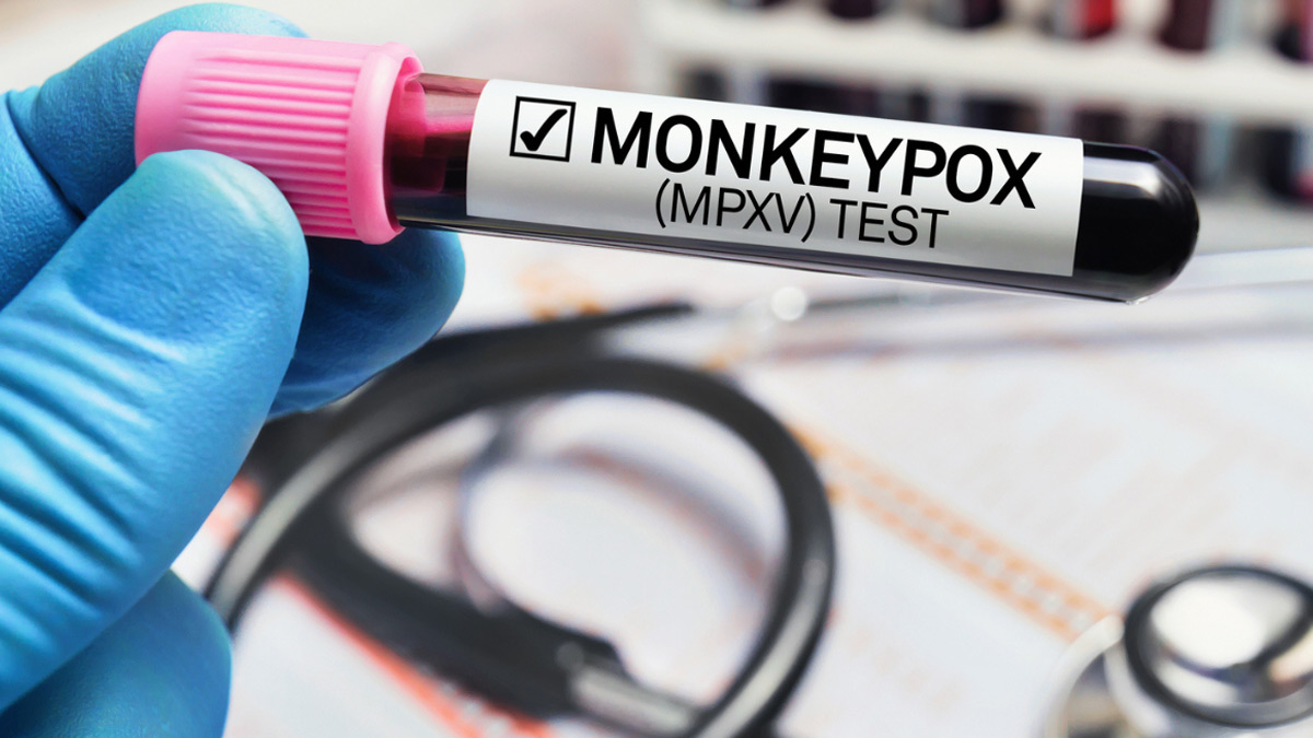 India Records First Suspected Mpox Case, Patient In Isolation | OnlyMyHealth